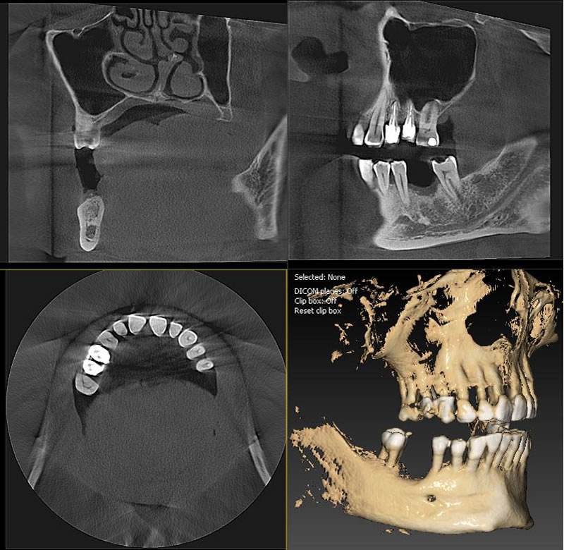 Machines Pan/Ceph/3D – Synca