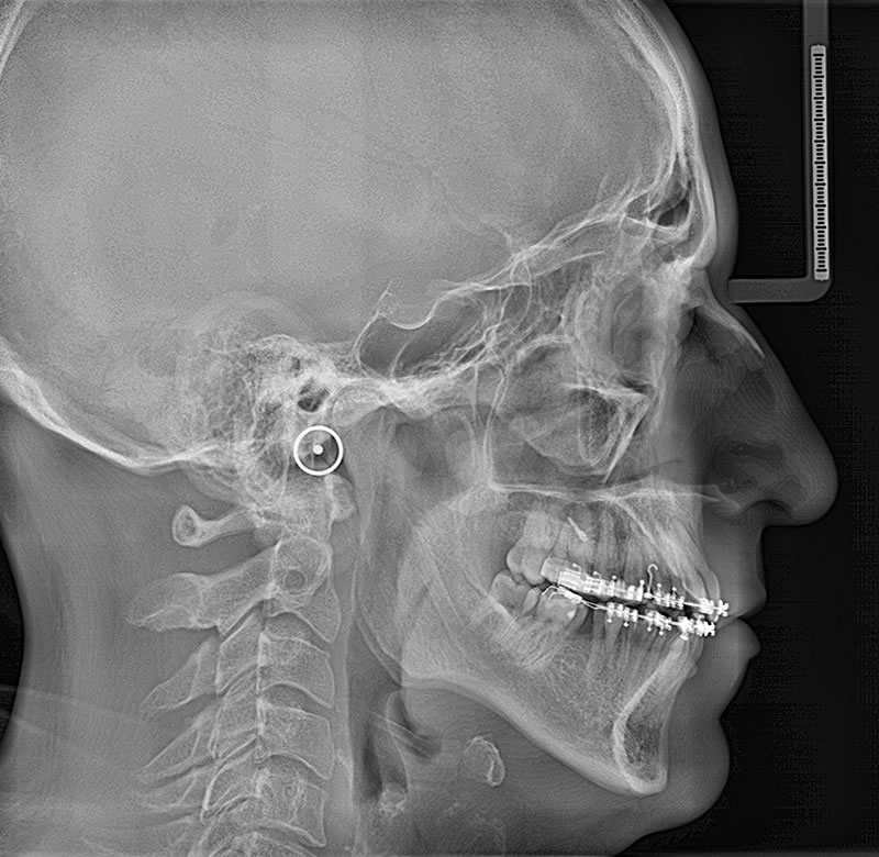 Machines Pan/Ceph/3D – Synca