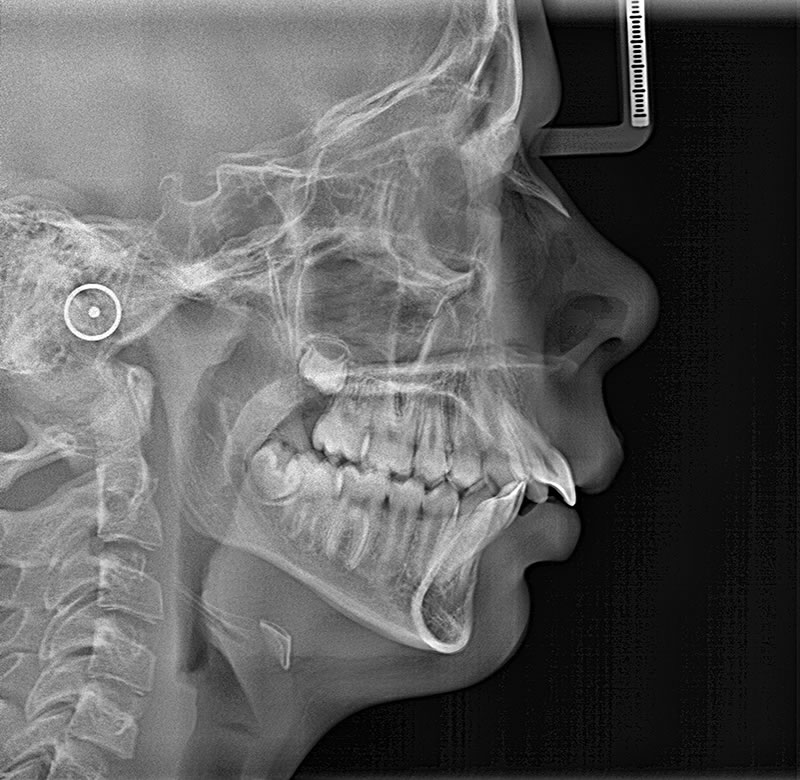 Machines Pan/Ceph/3D – Synca