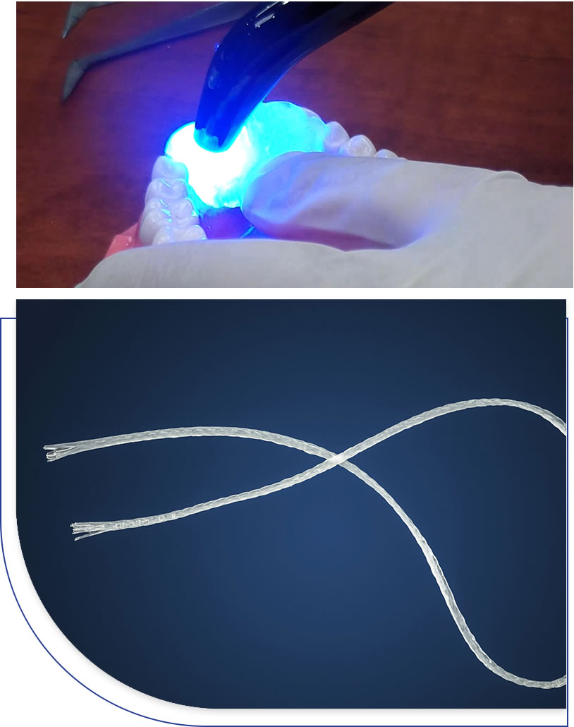 FAST SPLINT MATRIX® – Synca